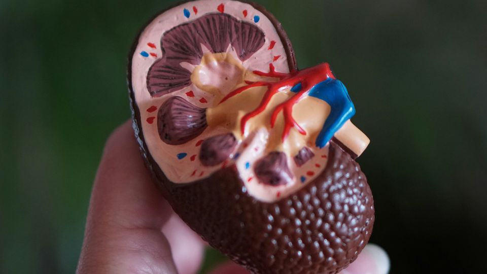 Rhabdomyolysis and Kidney Failure Modeled on a Human Chip | Technology ...