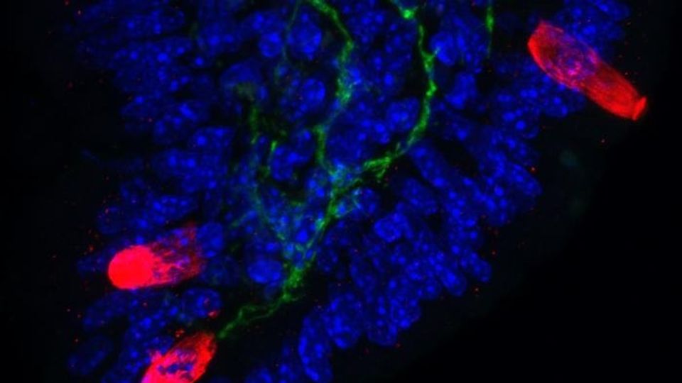 Gut Neurons Drive Allergies via Neural-Immune Networks | Technology ...