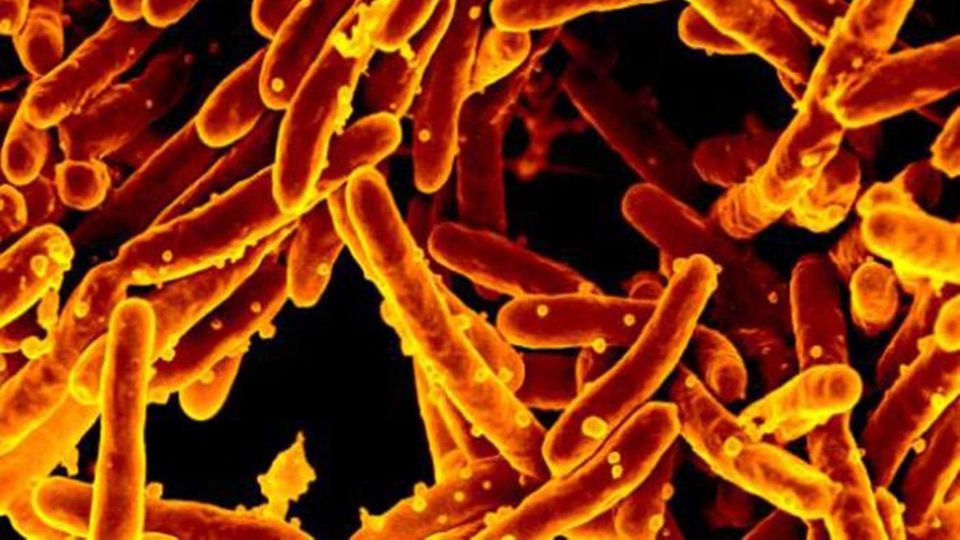Tuberculosis Immune Evasion: How TB Hijacks the Immune System ...