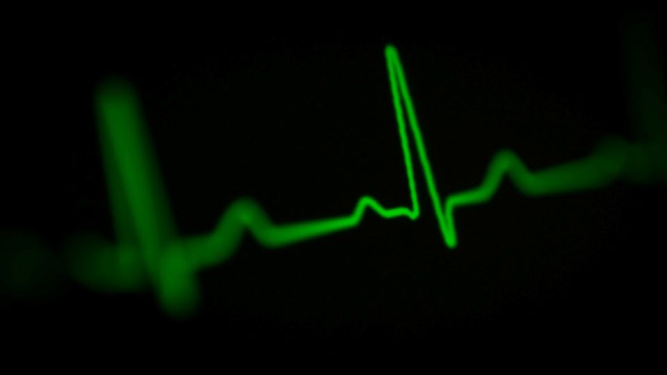 COPD Diagnosis Using ECG Enabled by Deep Learning Models | Technology ...