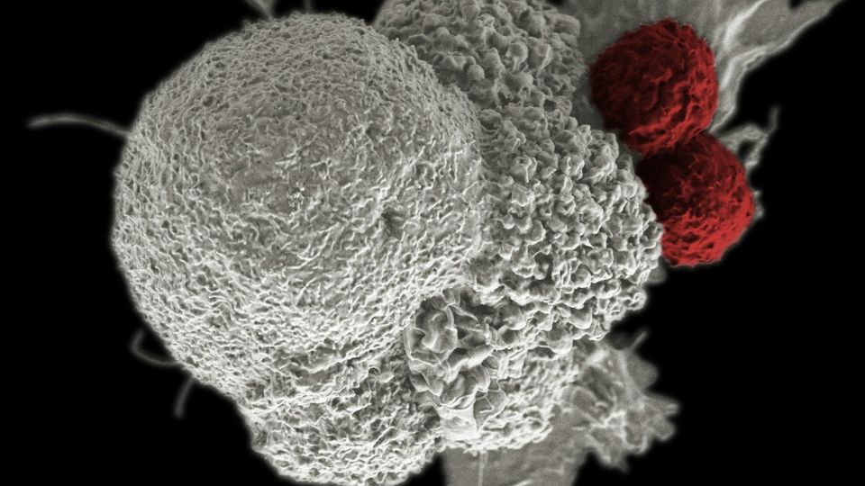 Lung Cancer Immunotherapy Boosted by Gut Bacteria Molecule | Technology ...