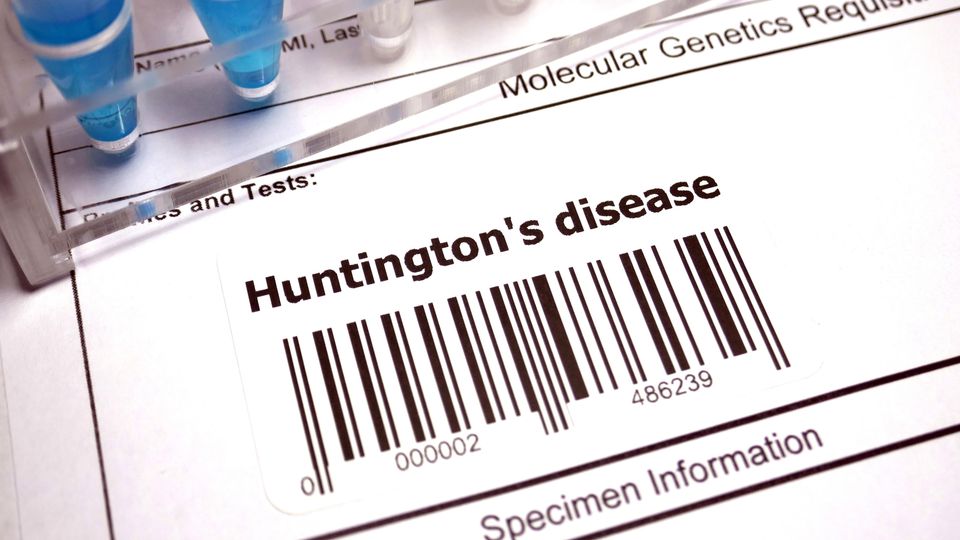 AI Explains Why Huntington’s Disease Onset Varies | Technology Networks