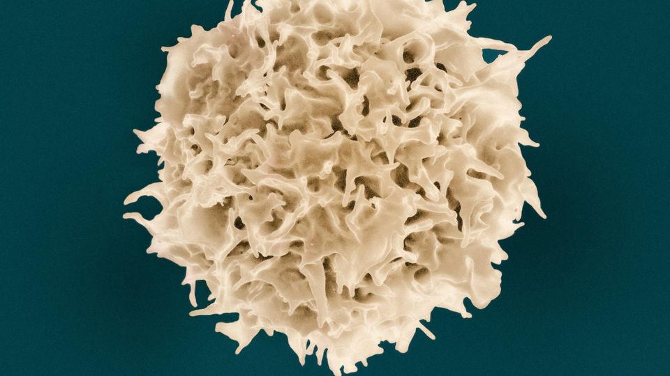Cancer Immunotherapy Breakthrough Targets T Cell Metabolism ...