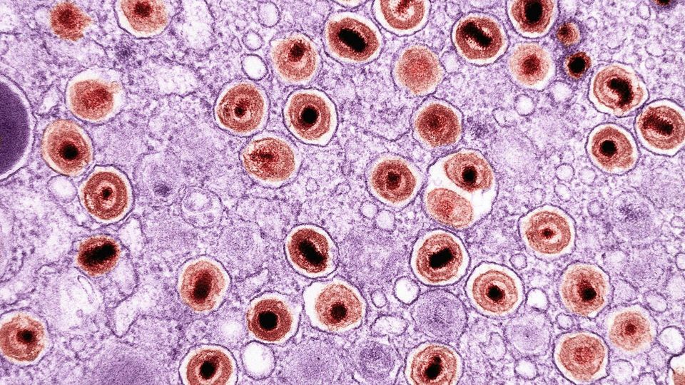 Virus Disrupts Immune Cell Traffic via CD44 | Technology Networks
