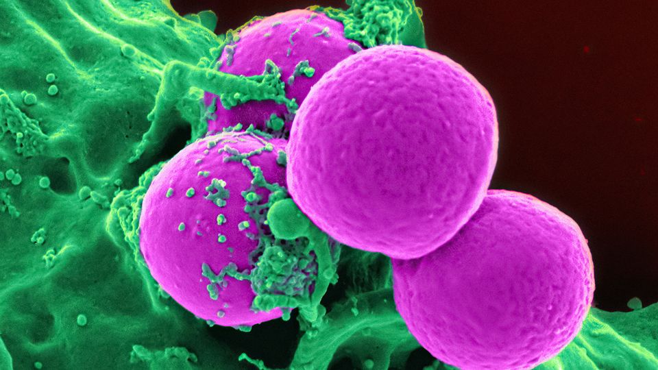New Copper-Based Drug Targets MRSA Biofilm Infections | Technology Networks