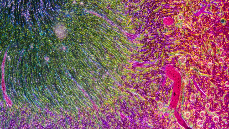 SGLT2 Inhibitors Slow Kidney Aging in Rapid-Aging Fish | Technology ...