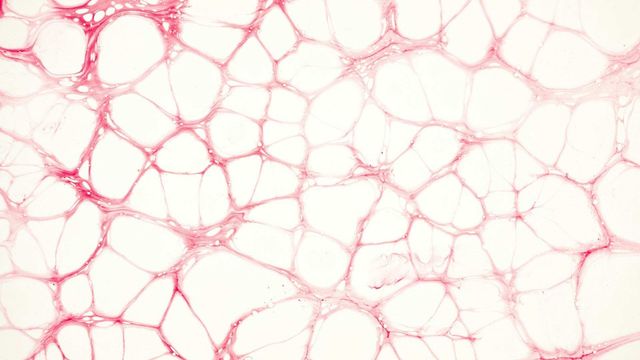 New Single-Cell Tool Redefines How Cells Decide To Die | Technology ...