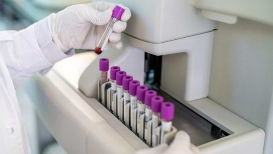 Blood Test To Improve Early Alzheimer’s Diagnosis | Technology Networks