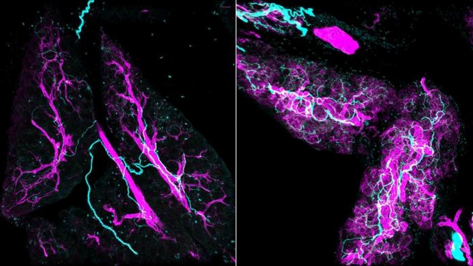 Nerve Signals Drive Early Pancreatic Cancer | Technology Networks