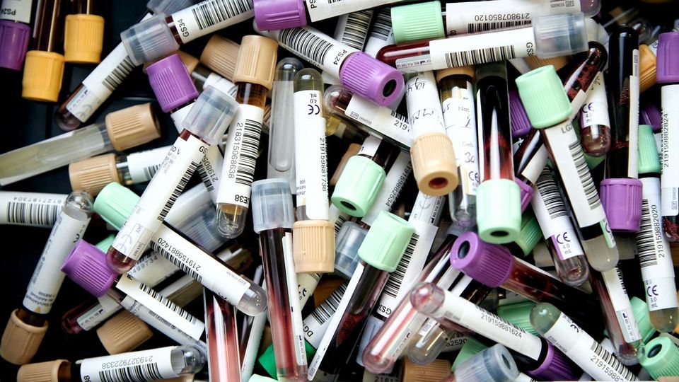Blood Omics Test Predicts Trauma Outcomes | Technology Networks
