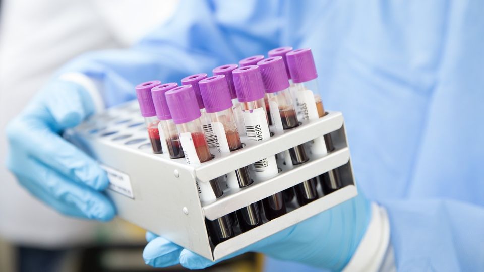 Blood Biomarkers Show Promise To Detect Pancreatic Cancer | Technology ...