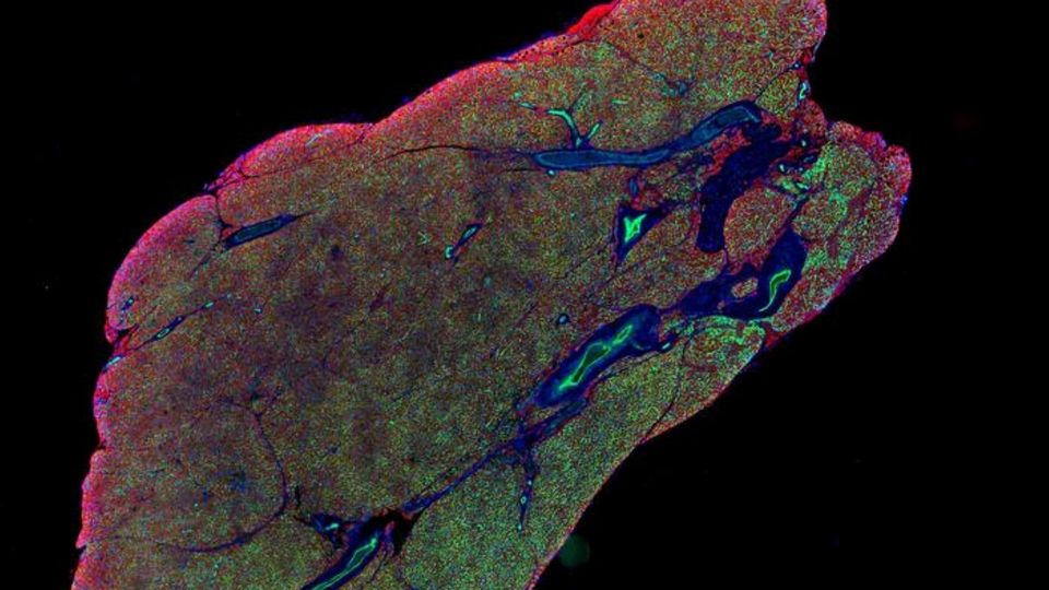 Protein Pathway Activates Brown Fat for Weight Loss | Technology Networks