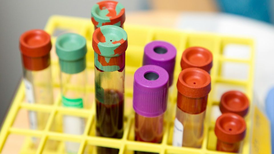 Roche Test To Enhance Blood Virus Detection | Technology Networks