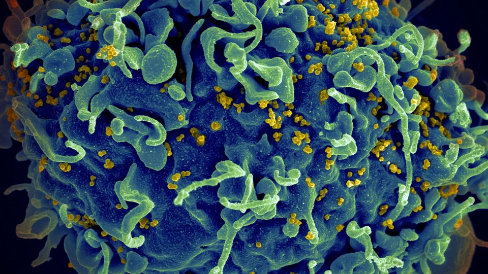 Human T Cell Gene Map Identifies Potential HIV Targets | Technology ...