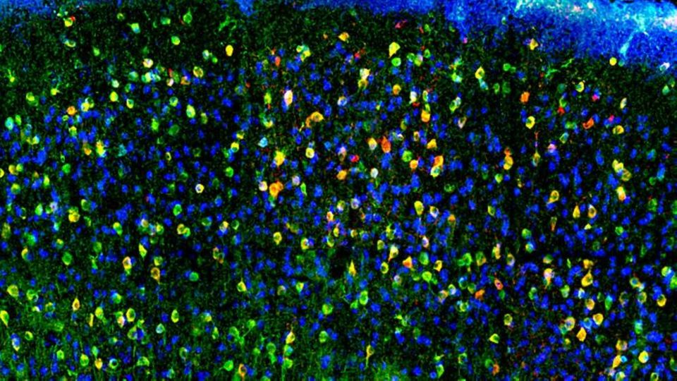 New Fluorescent Probes Improve Cell Imaging | Technology Networks