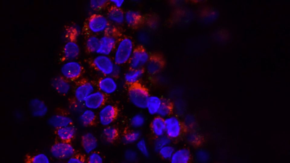 Peptide-Drug Conjugate Targets Metastatic Breast Cancer | Technology ...