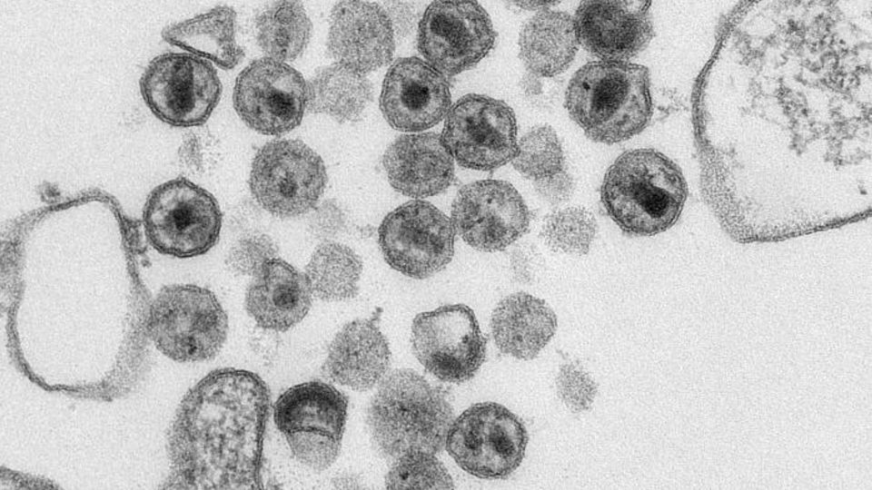 Gut Microbes May Boost Immunity in HIV Patients | Technology Networks