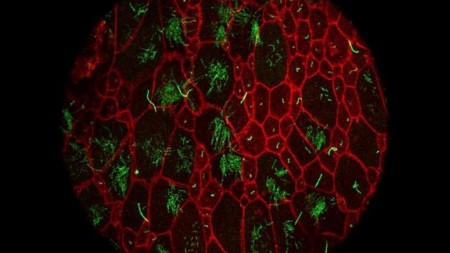 Primary Cilia May Influence Brain Development | Technology Networks