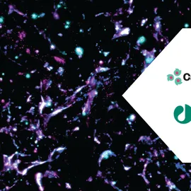 Organoid Study Tests New Spinal Cord Therapy | Technology Networks
