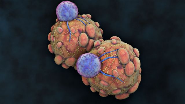 Tumor Genetics May Predict Gallbladder Cancer Outcomes | Technology ...