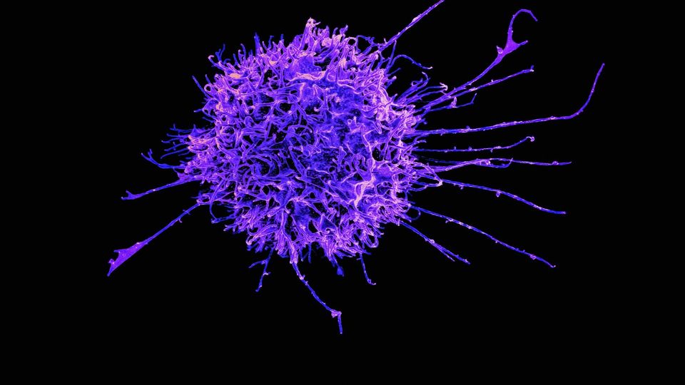 Suppressing Proteins Strengthened NK Cells | Technology Networks