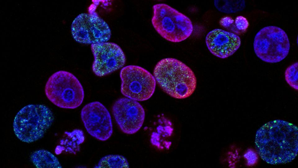 Blocking TBK1 May Improve KRAS Inhibitors | Technology Networks