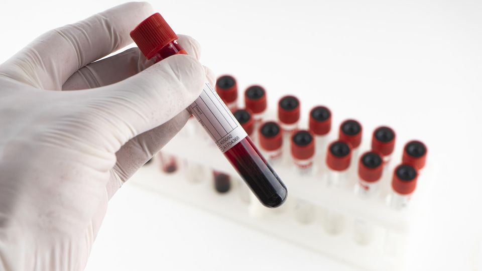 Blood Test Predicts Breast Cancer Relapse Early | Technology Networks