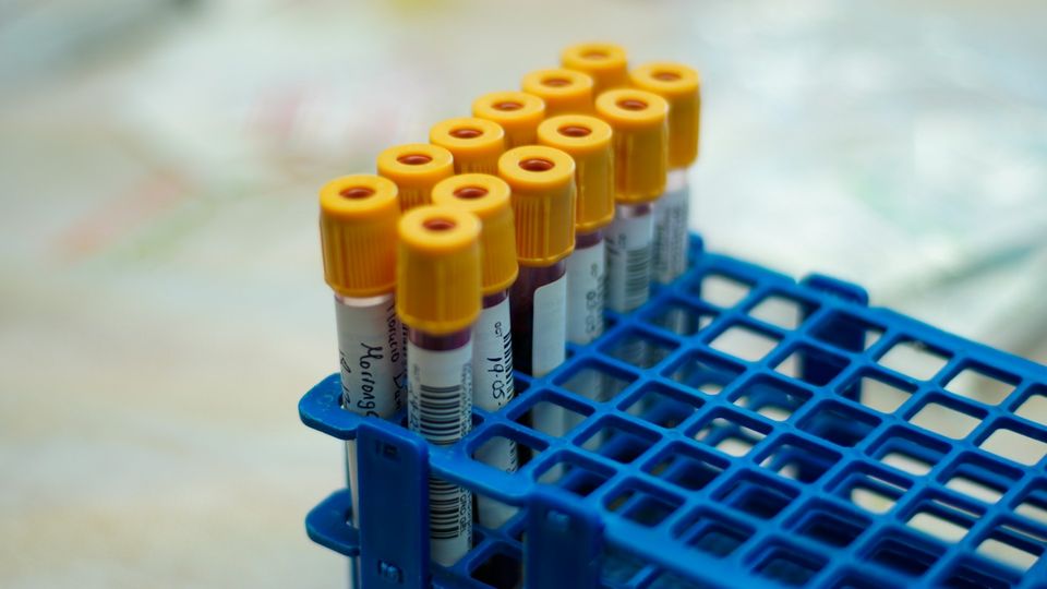 Blood Proteins May Predict Multiple Sclerosis | Technology Networks