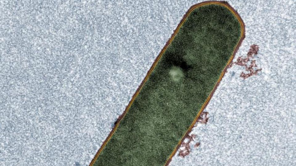 Scientists Reveal How Bacteria Keep Rod Shape | Technology Networks