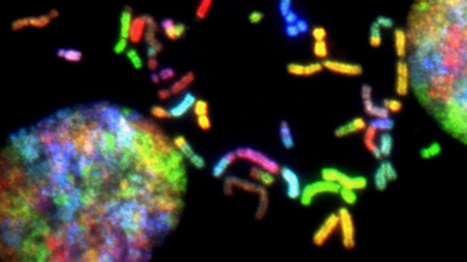 Chromosomal Instability Drives Aggressive Tumors | Technology Networks