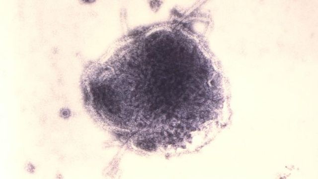 Cross-Reactive T Cells Target Measles and Nipah | Technology Networks