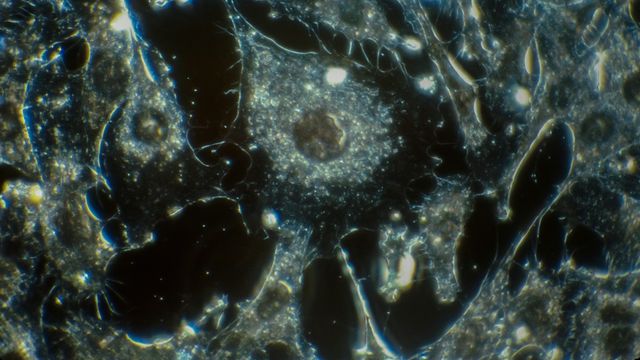 Novel Drug Aims To Disrupt Cancer Cell Energy Supply | Technology Networks