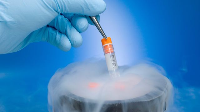 Microbiome Research: Best Practices for Sample Storage | Technology ...