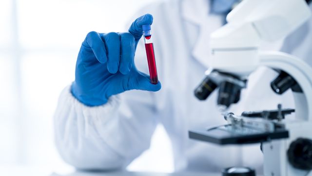 LRP5 Inhibition May Reduce Clots With Less Bleeding | Technology Networks