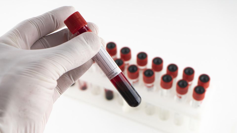 Blood Test Advances Pediatric IBD Diagnosis | Technology Networks